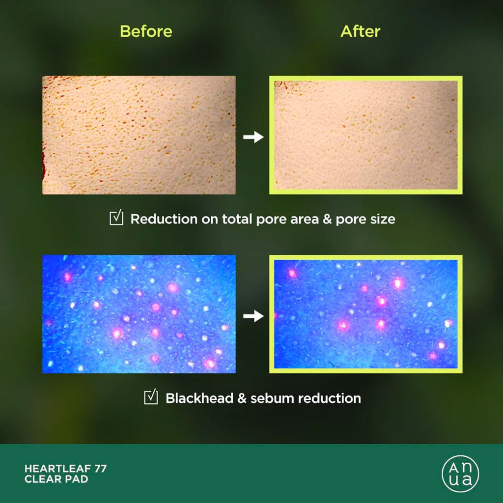 Anua Heartleaf 77 Clear Pad - Nudie Glow Australia