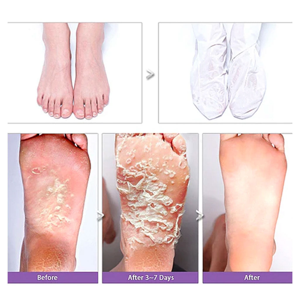 TONY MOLY Shiny Foot Super Peeling Liquid - Nudie Glow Australia