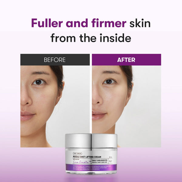 VT Cosmetics Reedle Shot Lifting Cream - Nudie Glow Australia