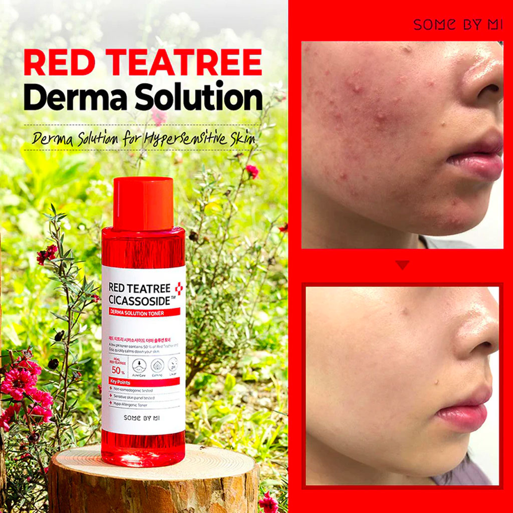 SOME BY MI Red Teatree Cicassoside Derma Solution Toner - Nudie Glow